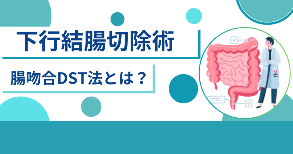 【下行結腸切除術の手術手順】腸吻合DST法の器械出し看護ポイントも解説｜オペ看向け勉強まとめ | 【オペ看が楽しくなる！】