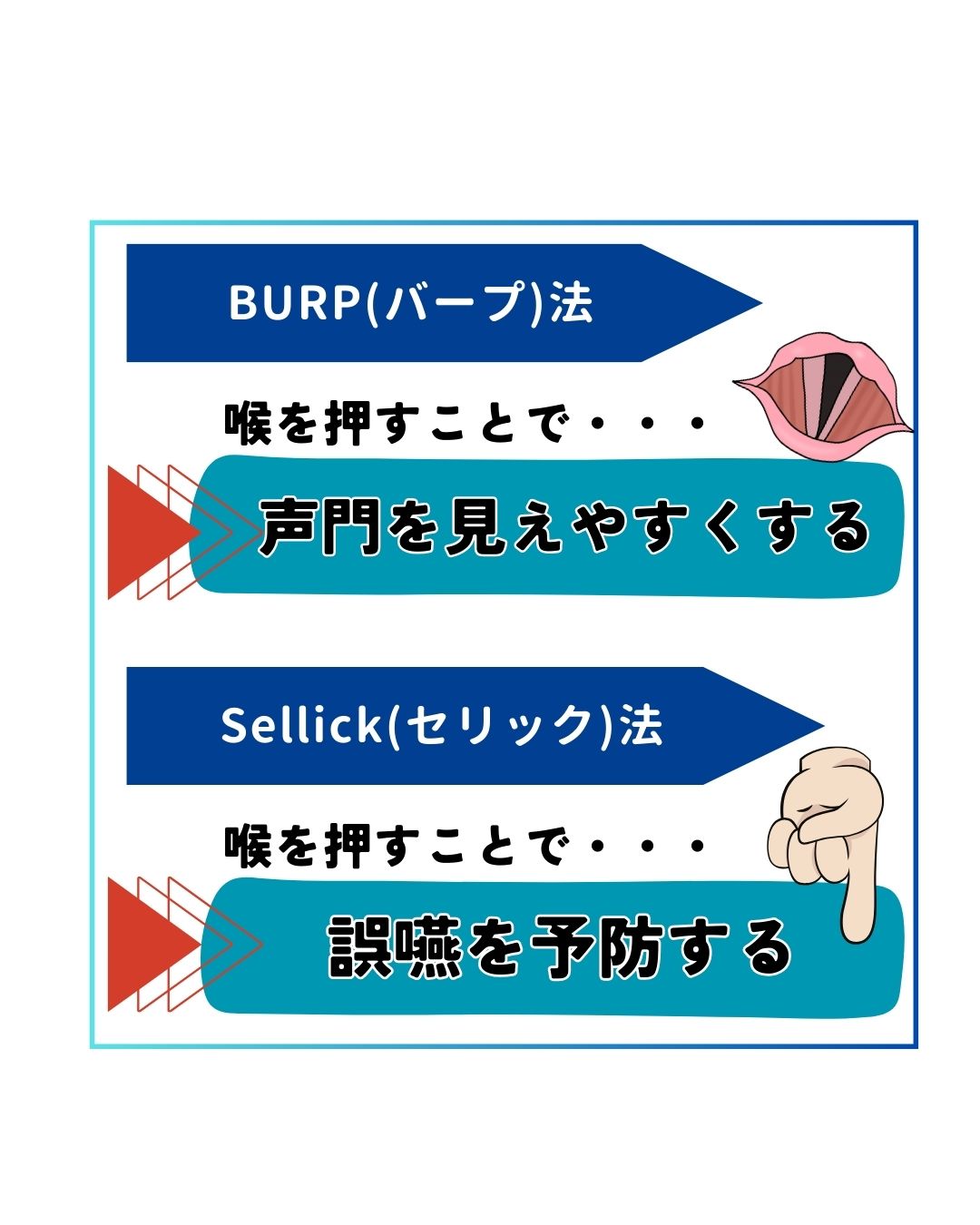 【オペ看勉強用】BURP(バープ)法とSellick(セリック)法はどう違う？挿管介助での喉の押し方を解説！ | 【オペ看が楽しくなる！】